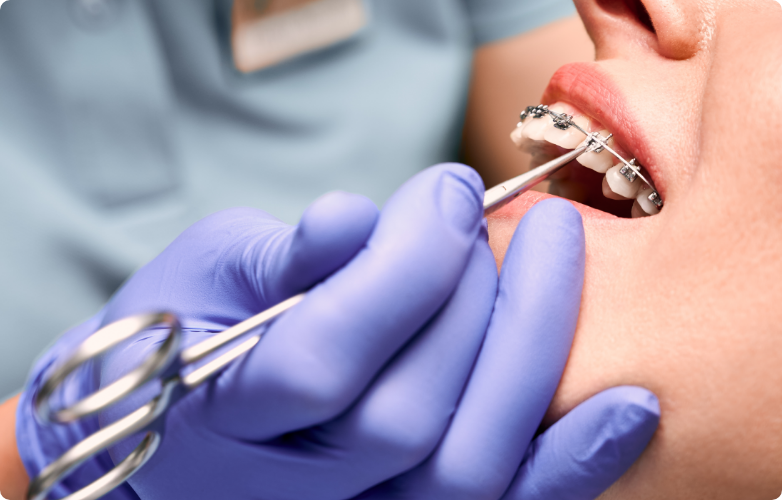 Spazio Dental - Ortodonzia